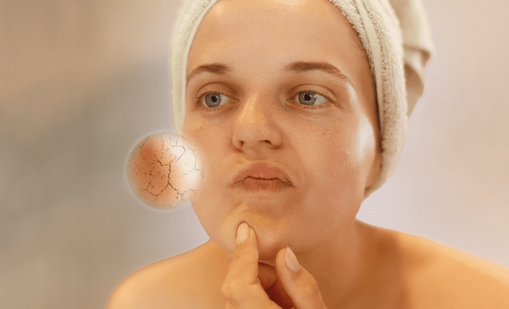 Productos para el cuidado de la piel seca